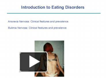 PPT – Introduction to Eating Disorders PowerPoint presentation | free ...