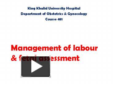 Management of labour presentation | free to view