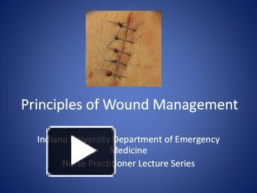 Principles of Wound Management presentation | free to view