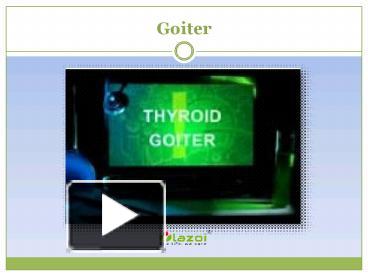 Goiter: Read about symptoms, causes and treatment presentation | free to download