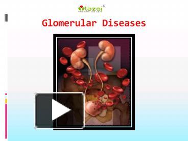 PPT – Glomerular Diseases: Glomerulosclerosis and Glomerulonephritis (2) PowerPoint presentation ...