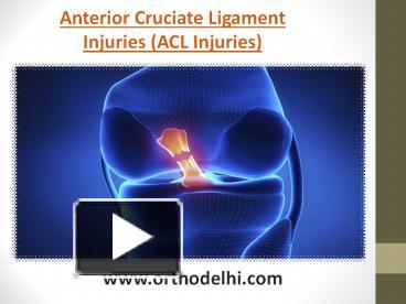 Anterior Cruciate Ligament Injuries (ACL Injuries) presentation | free to download