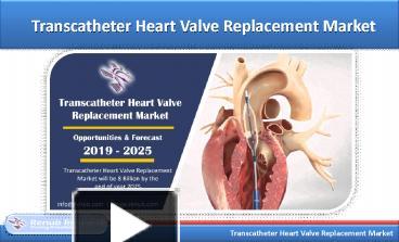 Transcatheter Heart Valve Replacement Market presentation | free to download