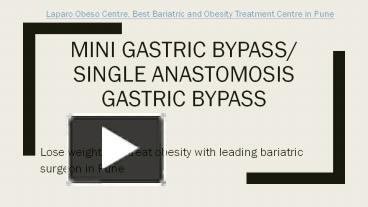 PPT – Mini Gastric Bypass/ Single Anastomosis Gastric Bypass PowerPoint presentation | free to ...