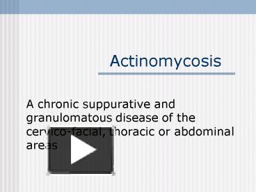 Actinomycosis presentation | free to view
