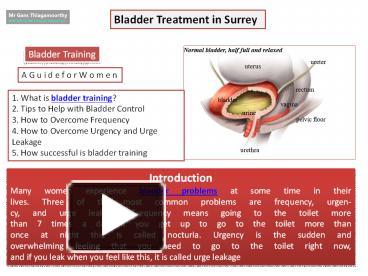 PPT – Bladder Treatment in Surrey PowerPoint presentation | free to download - id: 9389f8-MjE0M