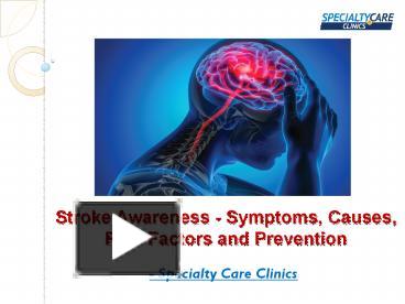 Stroke Awareness - Symptoms, Causes, Risk Factors and Prevention presentation | free to download