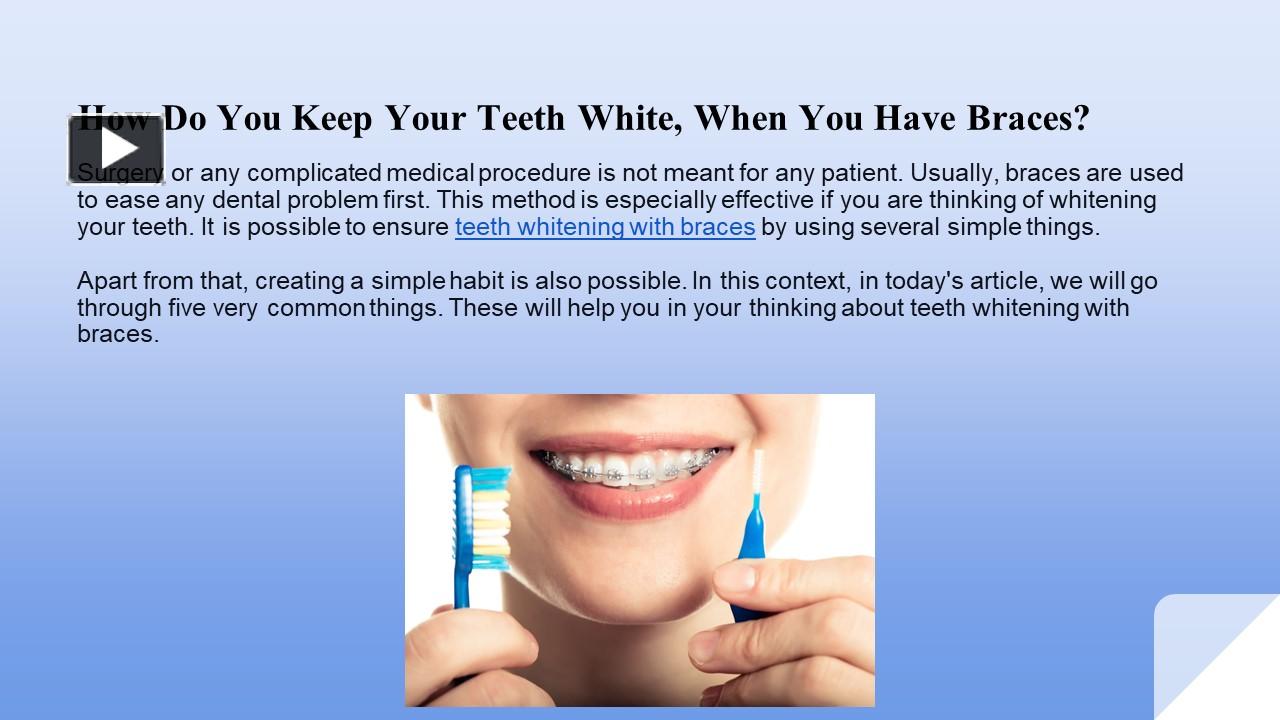 PPT – How Do You Keep Your Teeth White, When You Have Braces? PowerPoint presentation | free to ...