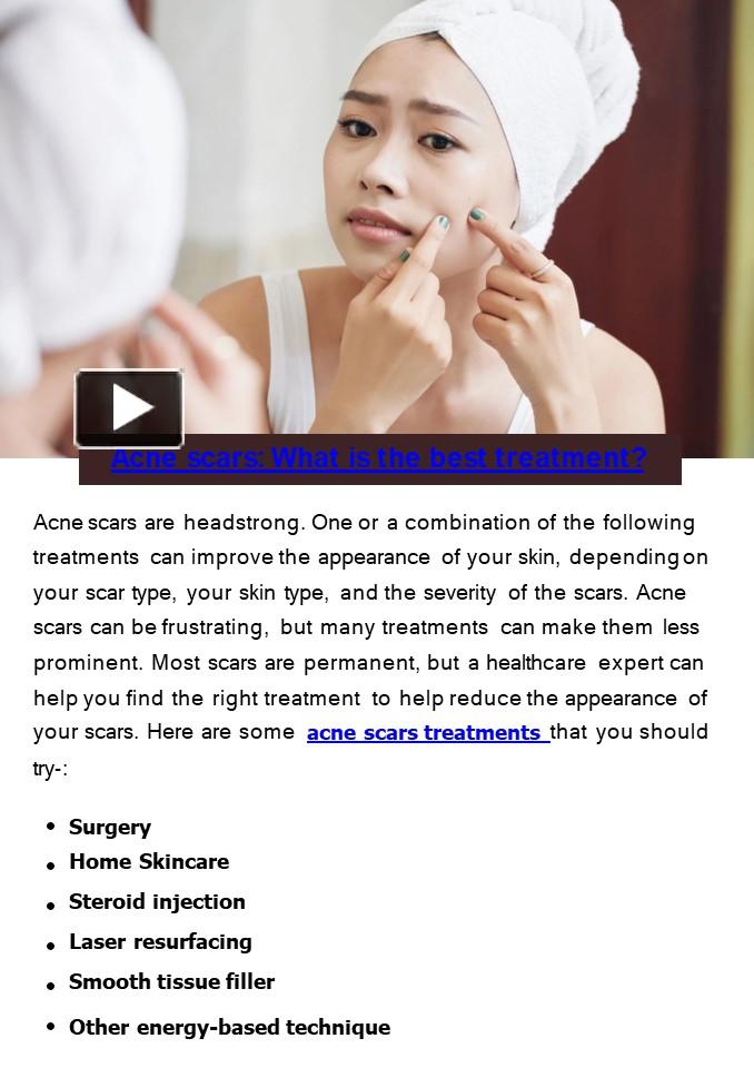 PPT – Acne scars: What is the best treatment? PowerPoint presentation | free to download - id ...