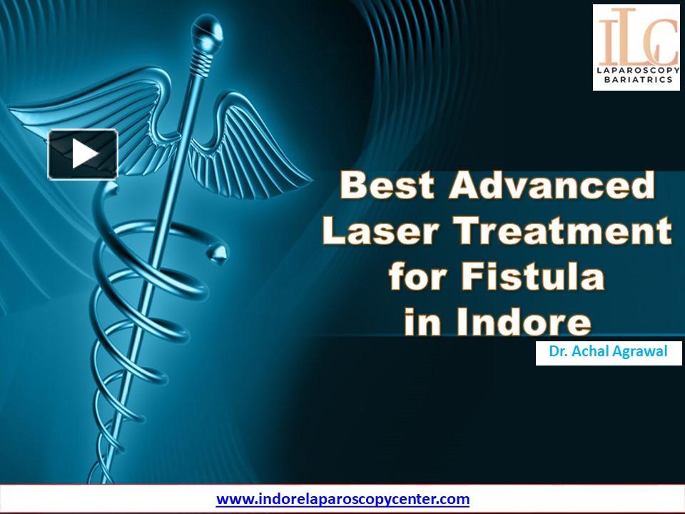 PPT – Best Advanced Laser Treatment for Fistula in Indore, MP PowerPoint presentation | free to ...