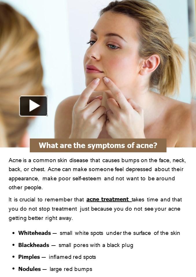 PPT – What are the symptoms of acne? PowerPoint presentation | free to download - id: 96247c-ZTdlY