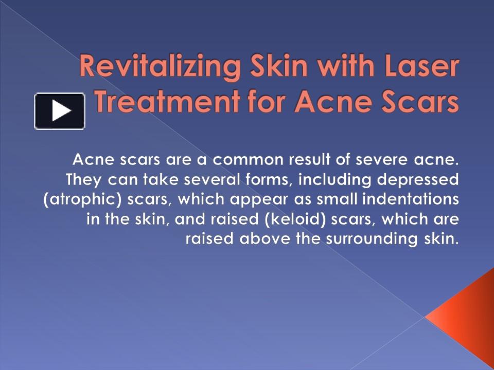 PPT – Revitalizing Skin with Laser Treatment for Acne Scars PowerPoint presentation | free to ...