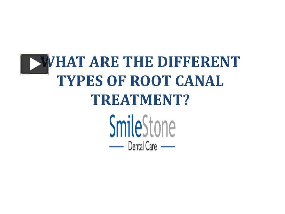 PPT – What are the different types of root canal treatment? PowerPoint presentation | free to ...
