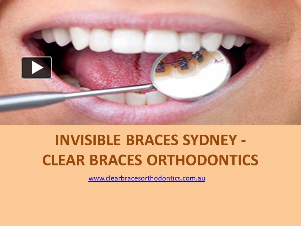 Invisible Braces Sydney - Clear Braces Orthodontics presentation | free to download