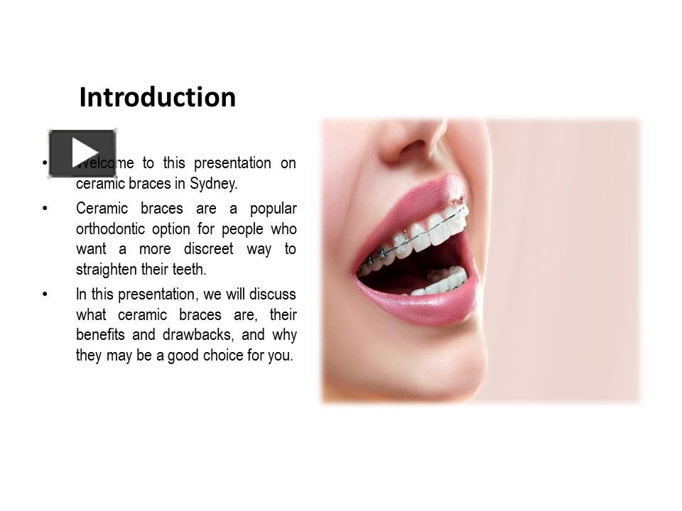 PPT – Ceramic braces Sydney PowerPoint presentation | free to download - id: 968cab-NTRjO