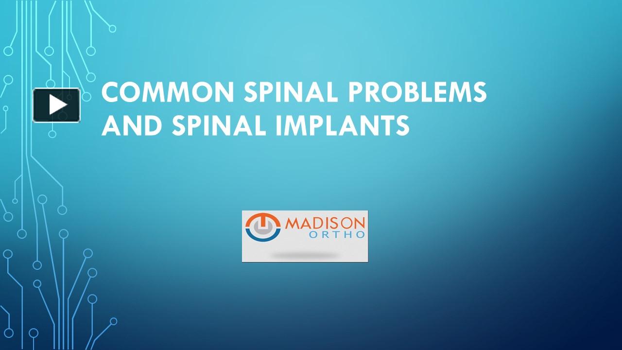 PPT – Common Spinal Problems And Spinal Implants PowerPoint presentation | free to download - id ...
