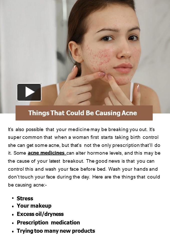 PPT – Things That Could Be Causing Acne PowerPoint presentation | free to download - id: 96a500 ...