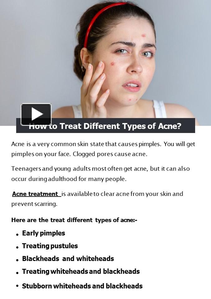 How to Treat Different Types of Acne? presentation | free to download
