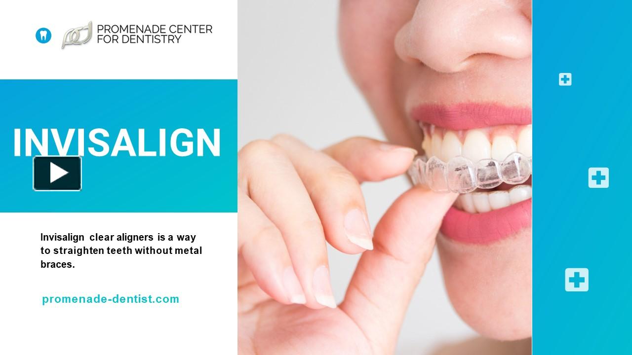 PPT – Invisalign in Charlotte PowerPoint presentation | free to download - id: 96b418-MTc4Z