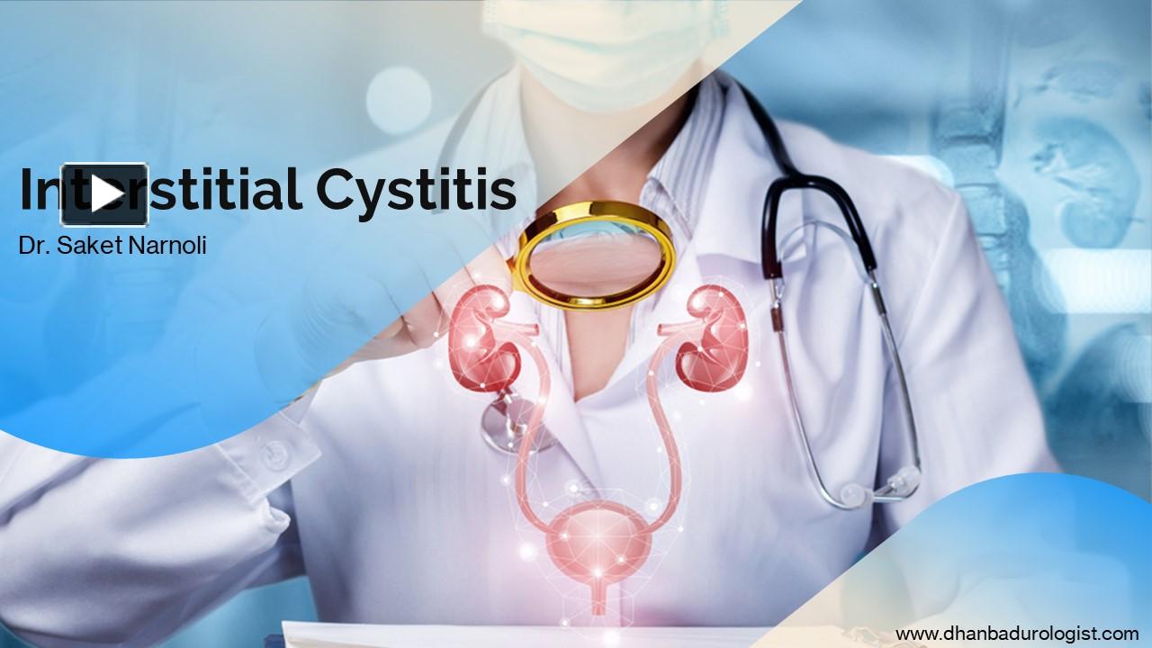 PPT – A Comprehensive Guide To Interstitial Cystitis PowerPoint presentation | free to download ...