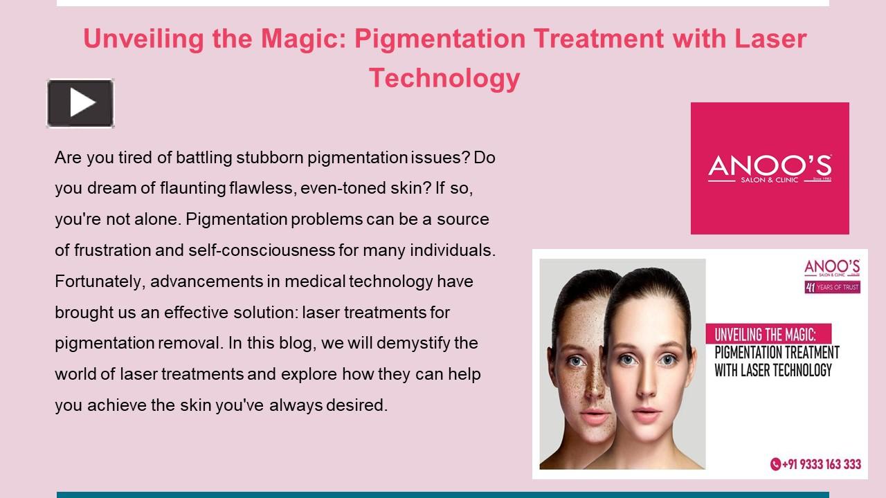 Unveiling the Magic: Pigmentation Treatment with Laser Technology presentation | free to download