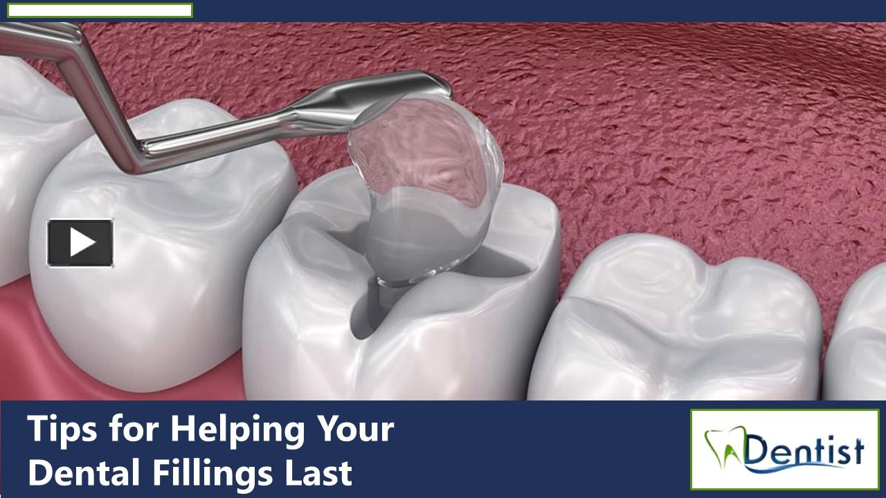 Unveiling the Secrets: Dental Fillings - How Long Do They Really Last? presentation | free to ...