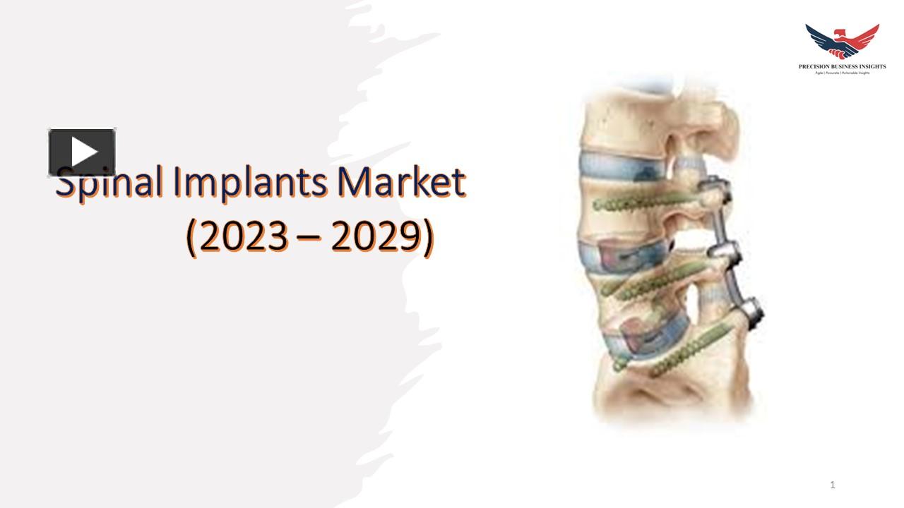 PPT – Spinal Implants Market Size, Share, Industry Growth 2029 PowerPoint presentation | free to ...