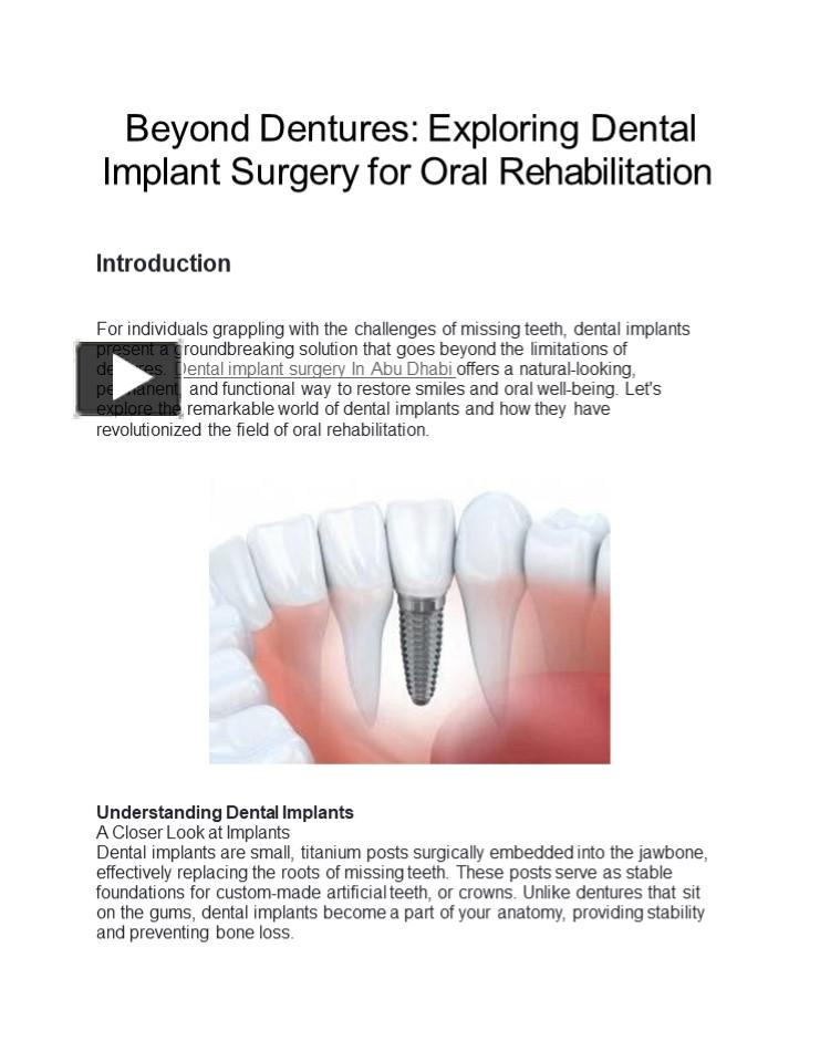 PPT – Beyond Dentures: Exploring Dental Implant Surgery for Oral Rehabilitation PowerPoint ...