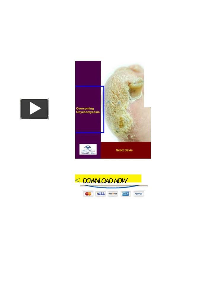 Overcoming Onychomycosis PDF Book Nail Fungus Natural Remedy presentation | free to download