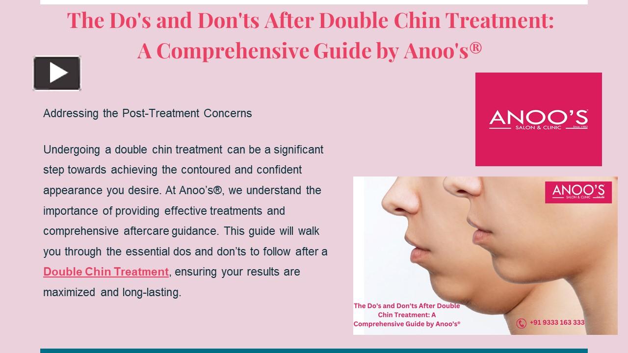 The Do's and Don'ts After Double Chin Treatment: A Comprehensive Guide by Anoo's® presentation ...
