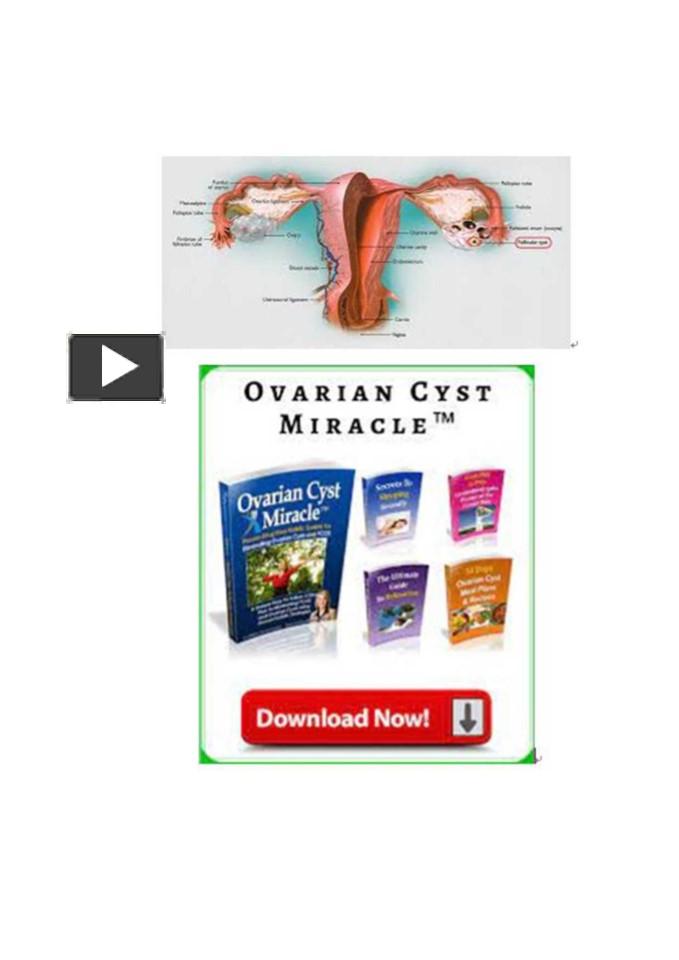 PPT – Ovarian Cyst Miracle PDF Manual & Guide eBook Download (1) PowerPoint presentation | free ...