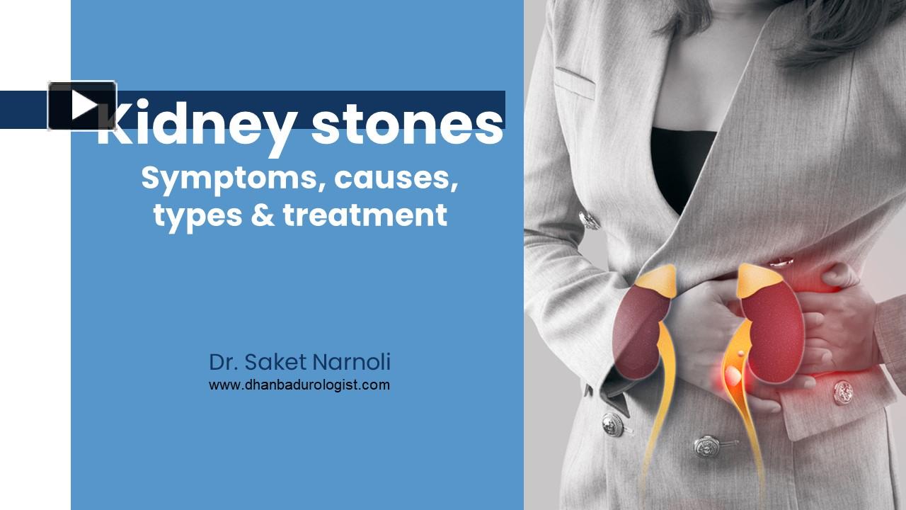 Kidney Stones Causes, Symptoms and treatment options presentation | free to download