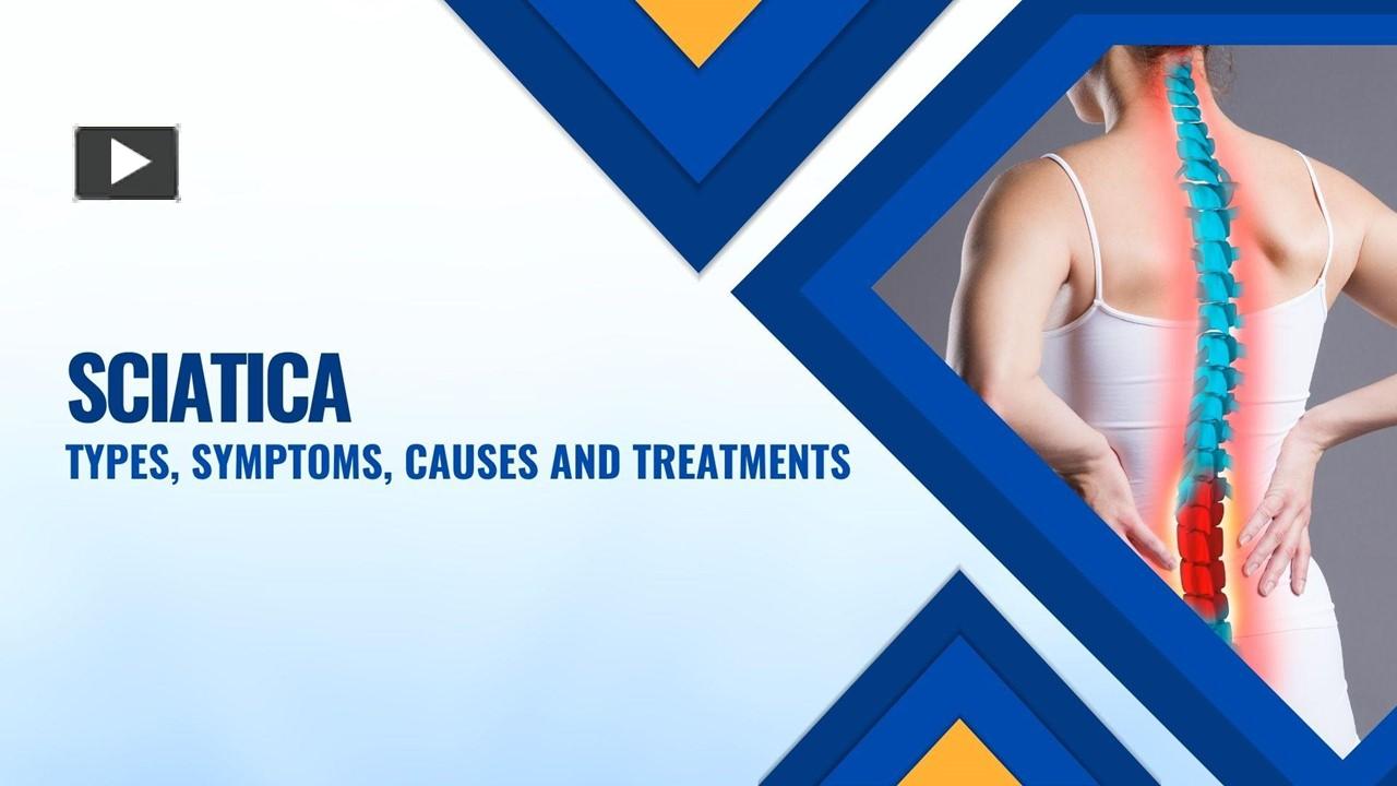 PPT – Sciatica- Types, symptoms, causes and Treatments PowerPoint presentation | free to ...
