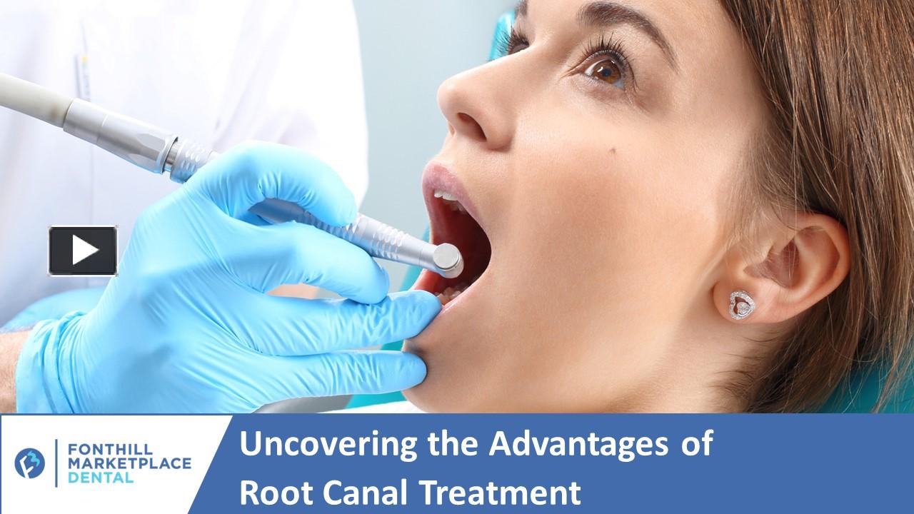 PPT – Discover the Benefits of Root Canal Treatment for Your Dental Health PowerPoint ...