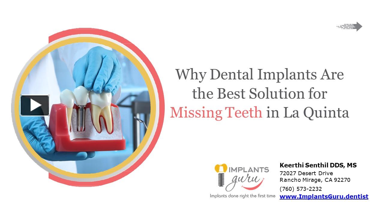 Why Dental Implants Are the Best Solution for Missing Teeth in La ...