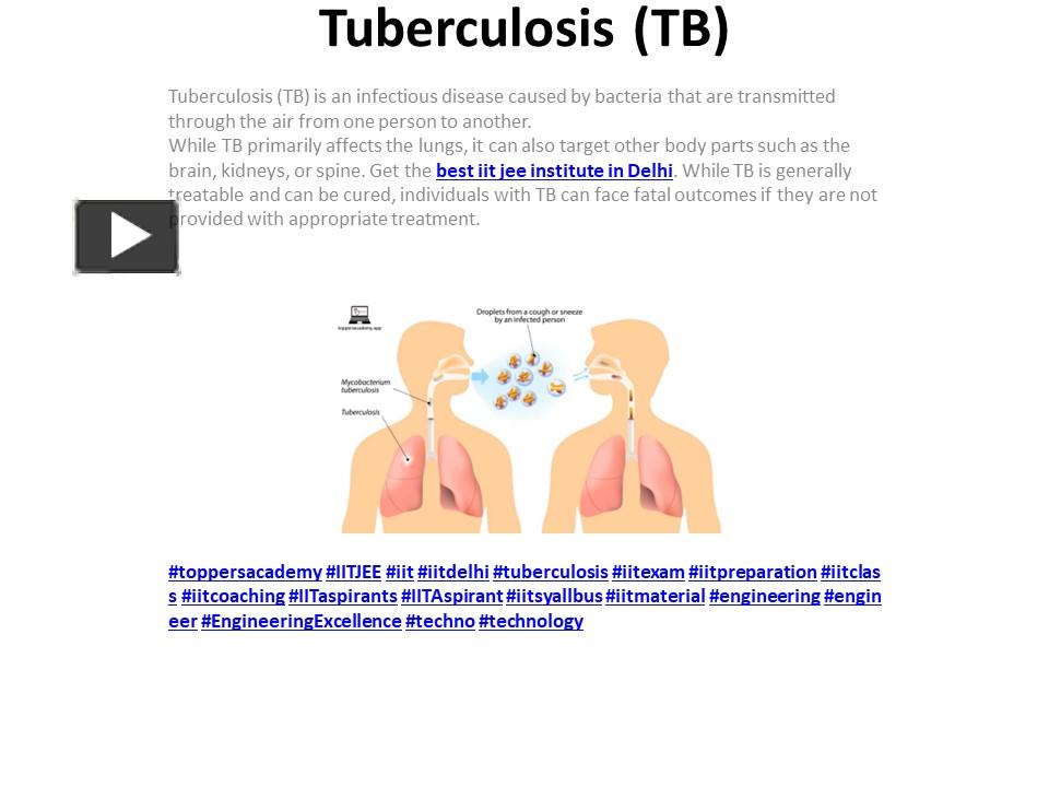 PPT – Tuberculosis (TB) PowerPoint presentation | free to download - id: 97f703-MzZhN