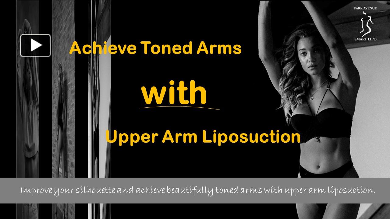 PPT – Achieve Toned Arms with Upper Arm Liposuction PowerPoint presentation | free to download ...