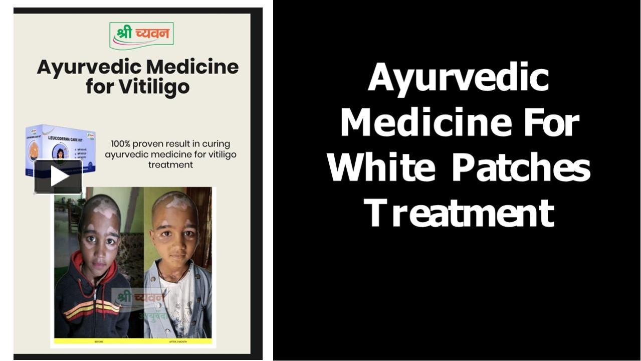 PPT – Ayurvedic medicine purchase online PowerPoint presentation | free to download - id: 98197b ...