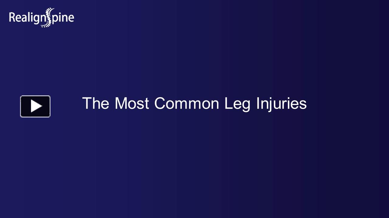 PPT – The Most Common Leg Injuries PowerPoint presentation | free to download - id: 9872ca-ZTg5Y