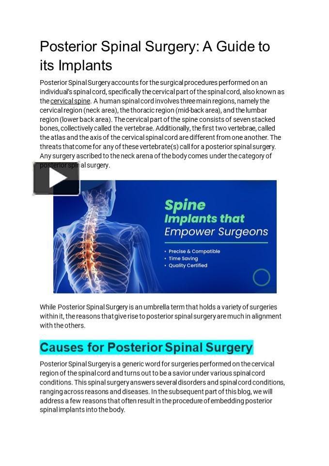PPT – Posterior Spinal Surgery: A Guide to its Implants PowerPoint presentation | free to ...
