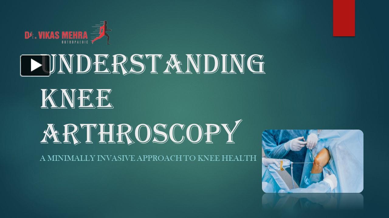 PPT – Understanding Knee Arthroscopy PowerPoint presentation | free to ...
