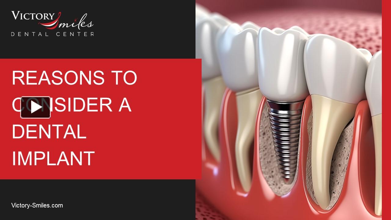 PPT – Reasons to Consider a Dental Implant (1) PowerPoint presentation | free to download - id ...