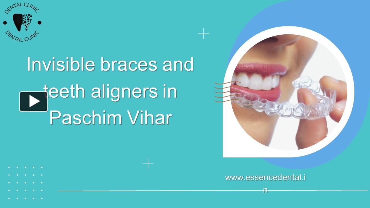 PPT – Invisible Braces and Teeth Aligners in Paschim Vihar PowerPoint presentation | free to ...