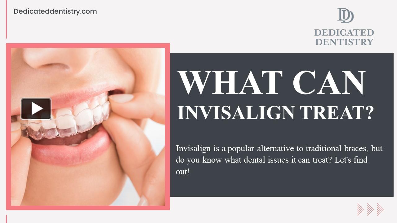 PPT – What Can Invisalign Treat? PowerPoint presentation | free to download - id: 990cca-ZmVmY