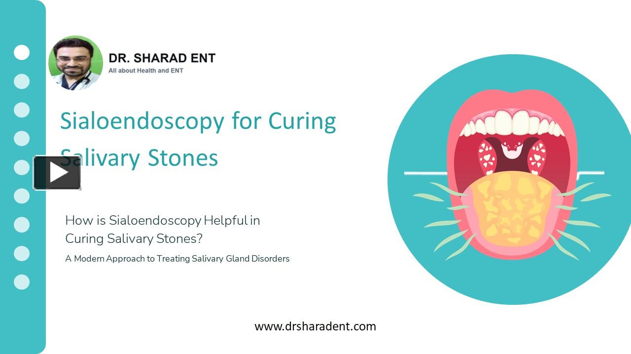 How is Sialoendoscopy Helpful in Curing Salivary Stones? - Dr Sharad ENT presentation | free to ...