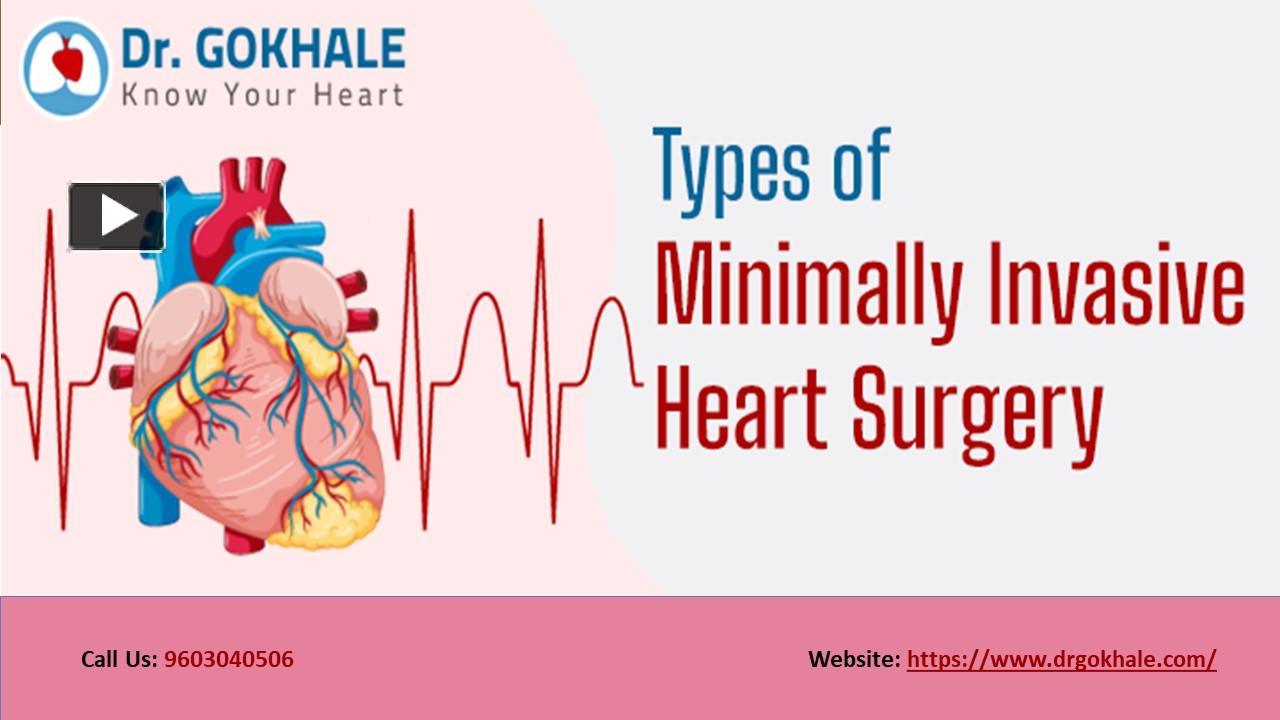 Ppt Types Of Minimally Invasive Heart Surgery Dr Gokhale Surgeon