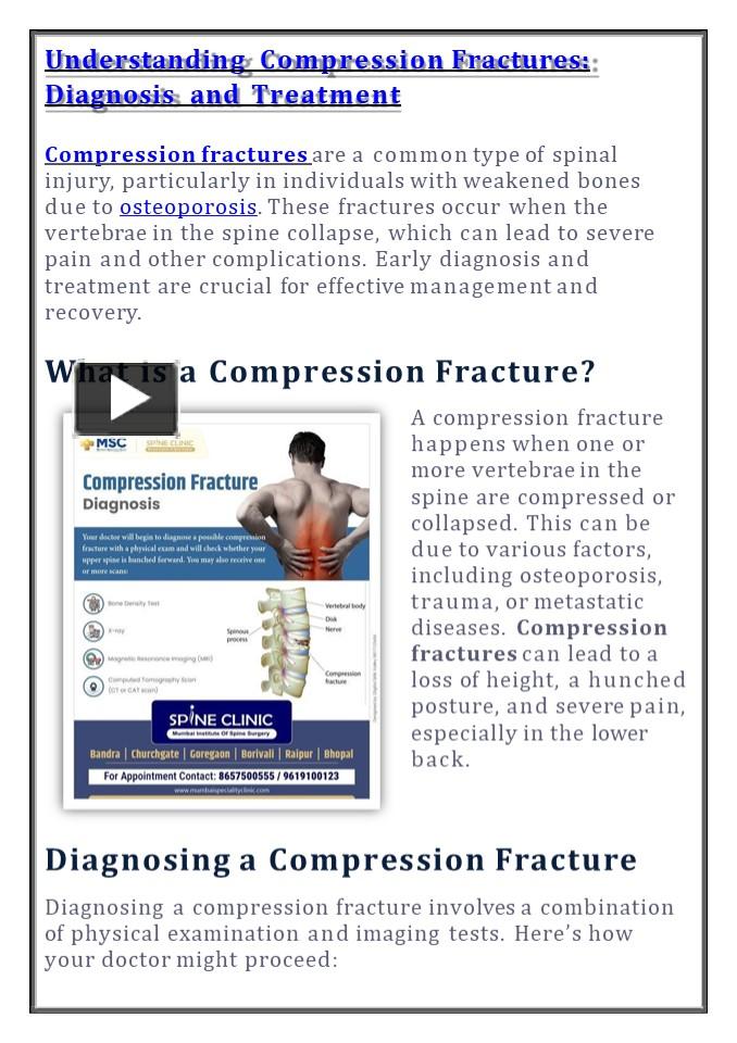 Understanding Compression Fractures Diagnosis And Treatment Presentation Free To Download
