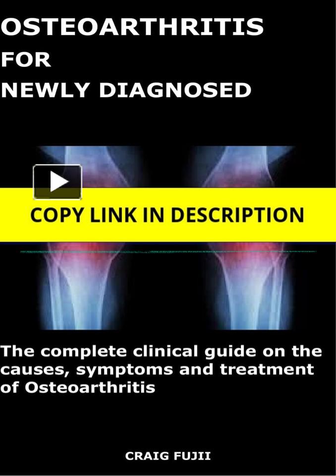 PPT – [PDF] OSTEOARTHRITIS FOR NEWLY DIAGNOSED: The complete clinical guide on the causes ...