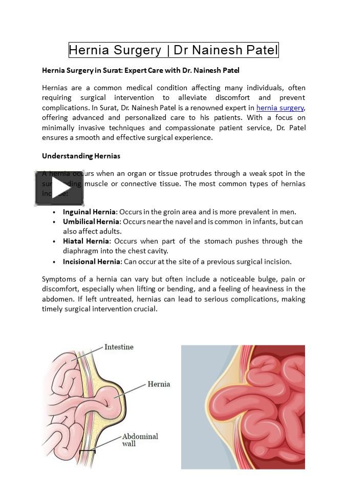 PPT – Hernia Surgery in Surat | Dr Nainesh Patel PowerPoint presentation | free to download - id ...