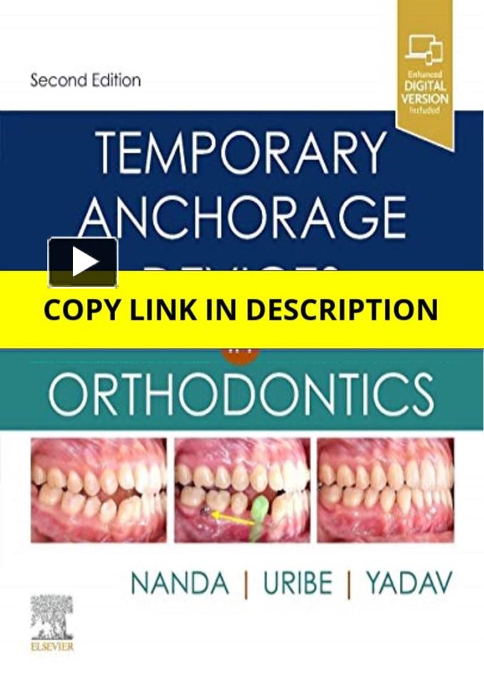 [PDF] Temporary Anchorage Devices in Orthodontics 2nd Edition Full presentation | free to download